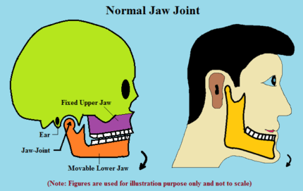 15 Causes of Jaw Pain and Dysfunction: A Comprehensive Guide - Gateway ...